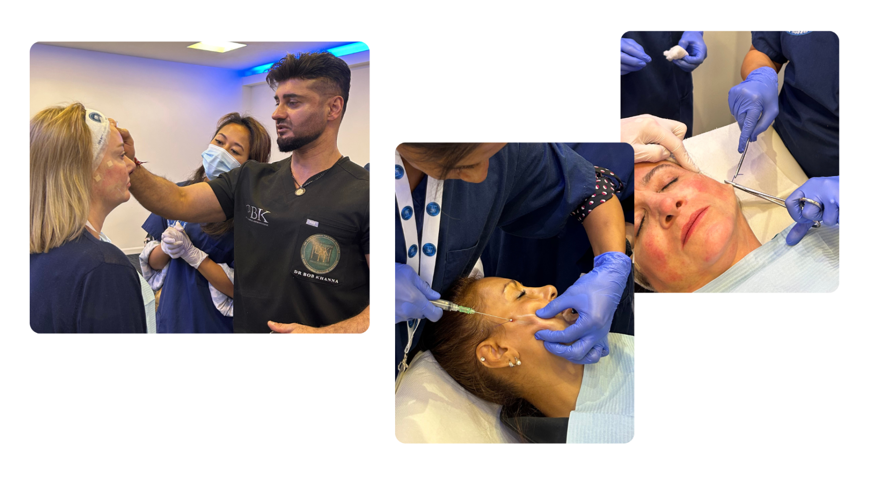 Advanced Thread Lifting - Dr Bob Khanna Training Institute