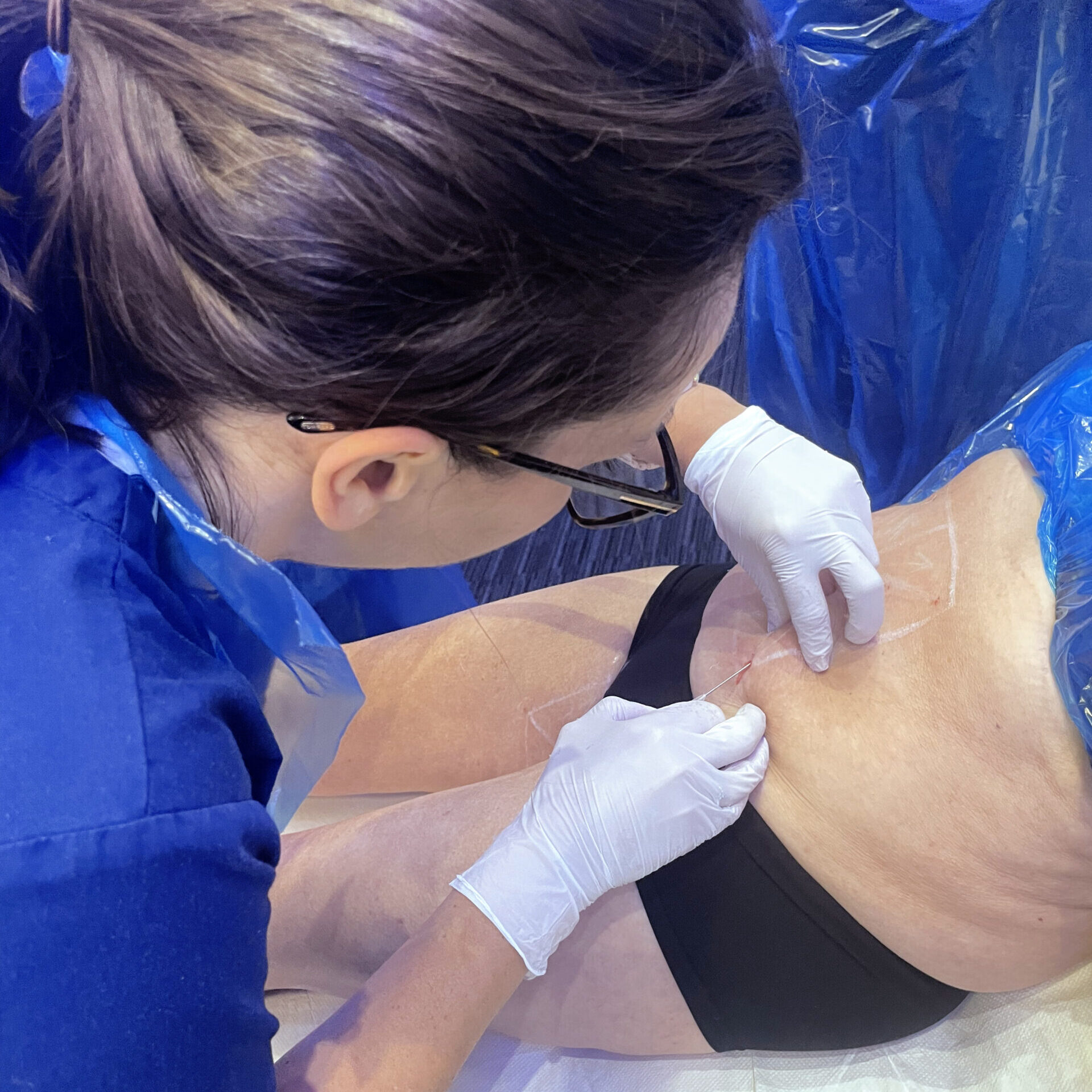 Fat Dissolving Courses | Enhance Your Clinic & Book Today