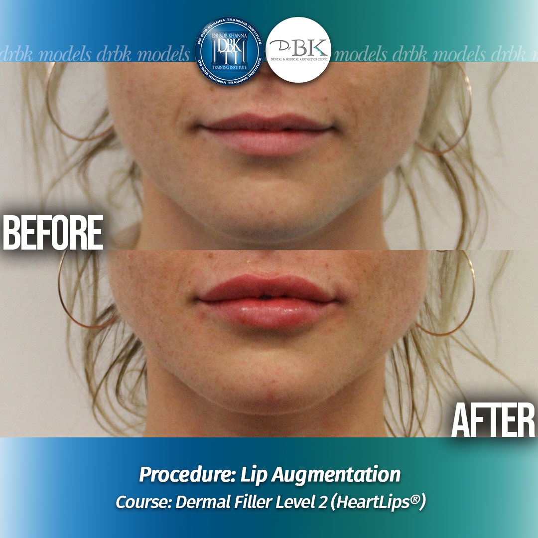 Become A Model - Dr Bob Khanna Training Institute